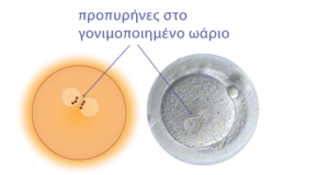 in vitro Γονιμοποίηση - Genesis Crete